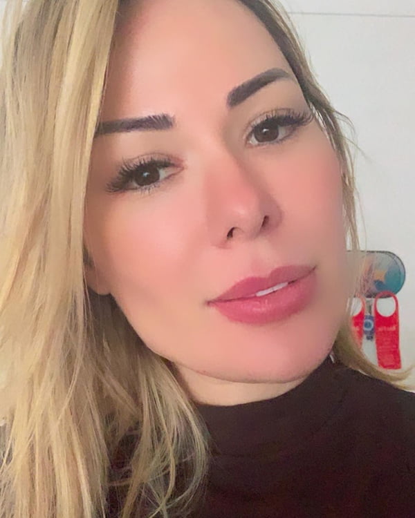 Ju Isen Mostra Resultado Depois De 50 Plásticas Nova Mulher” Metrópoles