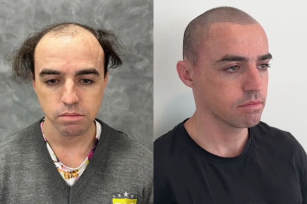 Homem passa por transformação completa no visual e resultado choca web ...