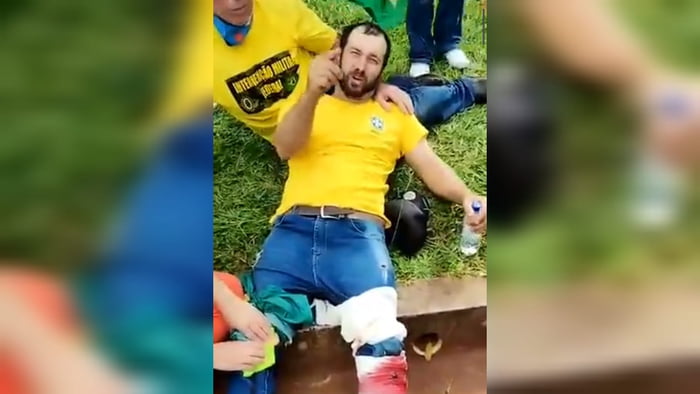Bolsonarista diz ter sido atingido por três tiros em manifestação na ...
